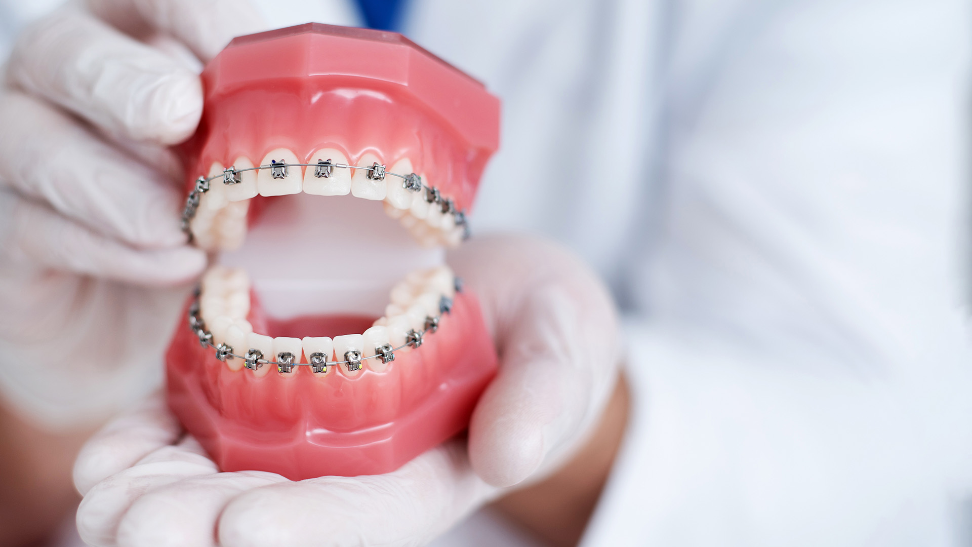 How Orthodontics Shapes Your Facial Structure: A Complete Guide
